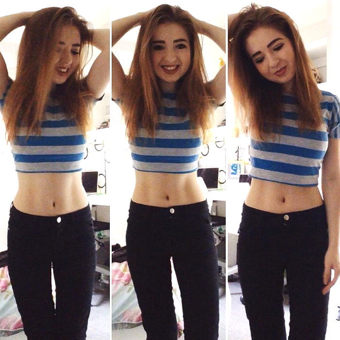 ‘25kg’이었던 10대 소녀가 거식증 극복한 방법 - 인사이트