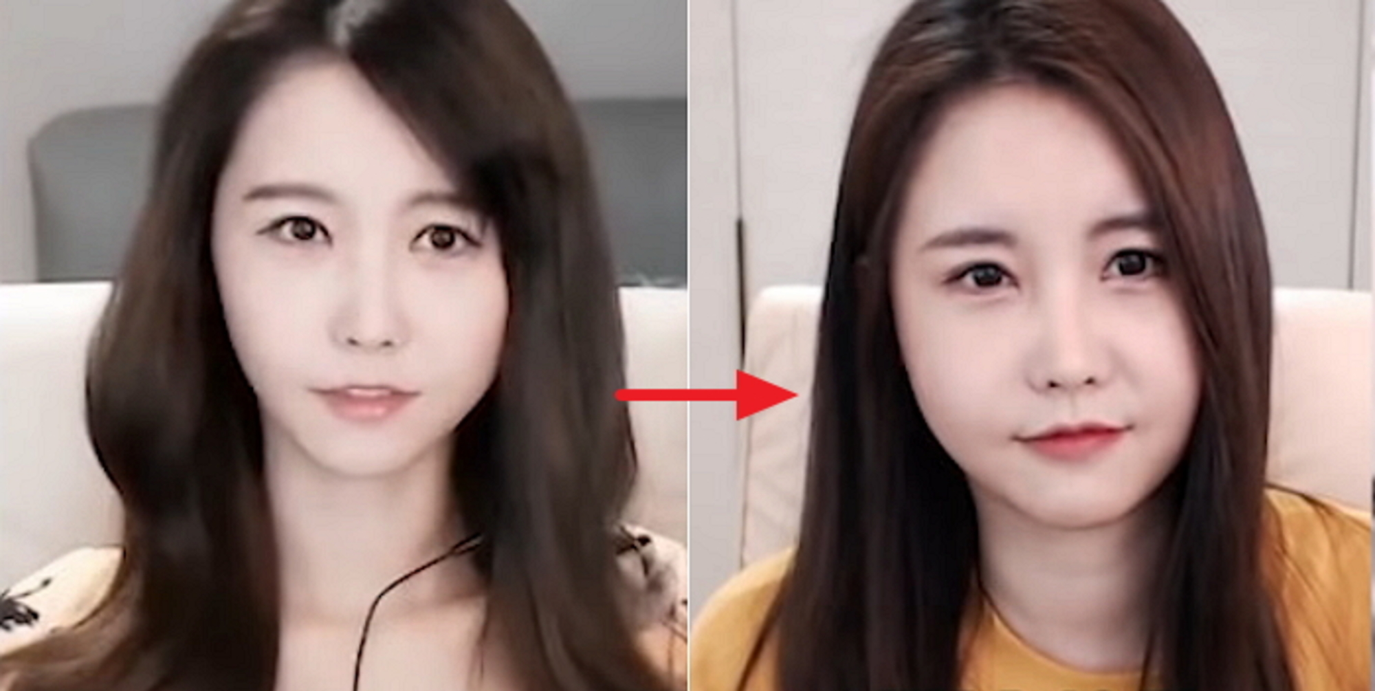 ‘신장이식’ 수술 후 47kg서 ‘72kg’까지 찐 BJ 윰댕 (영상) - 인사이트