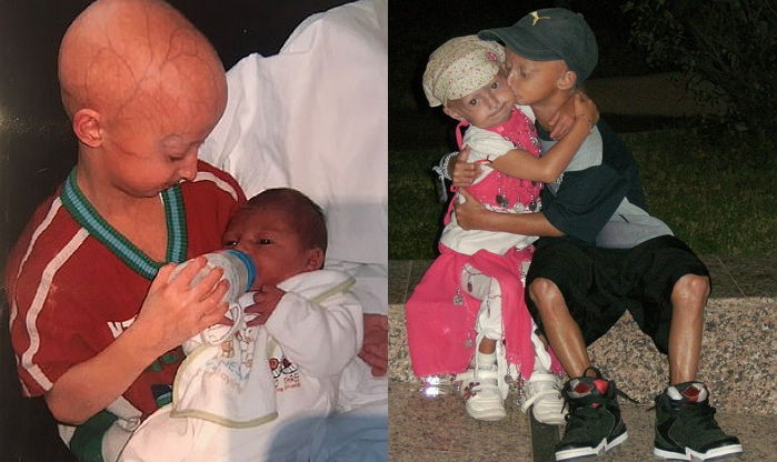 자신과 똑같이 늙어가는 ‘조로증’ 걸린 동생 24시간 지켜주는 보디가드 오빠 - 인사이트