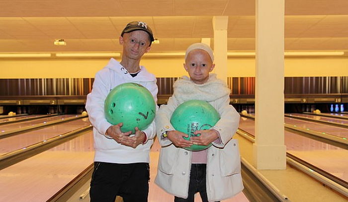 자신과 똑같이 늙어가는 ‘조로증’ 걸린 동생 24시간 지켜주는 보디가드 오빠 - 인사이트