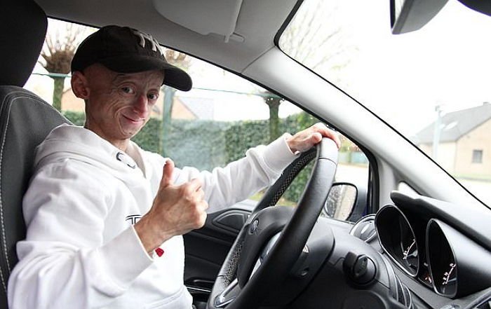 자신과 똑같이 늙어가는 ‘조로증’ 걸린 동생 24시간 지켜주는 보디가드 오빠 - 인사이트